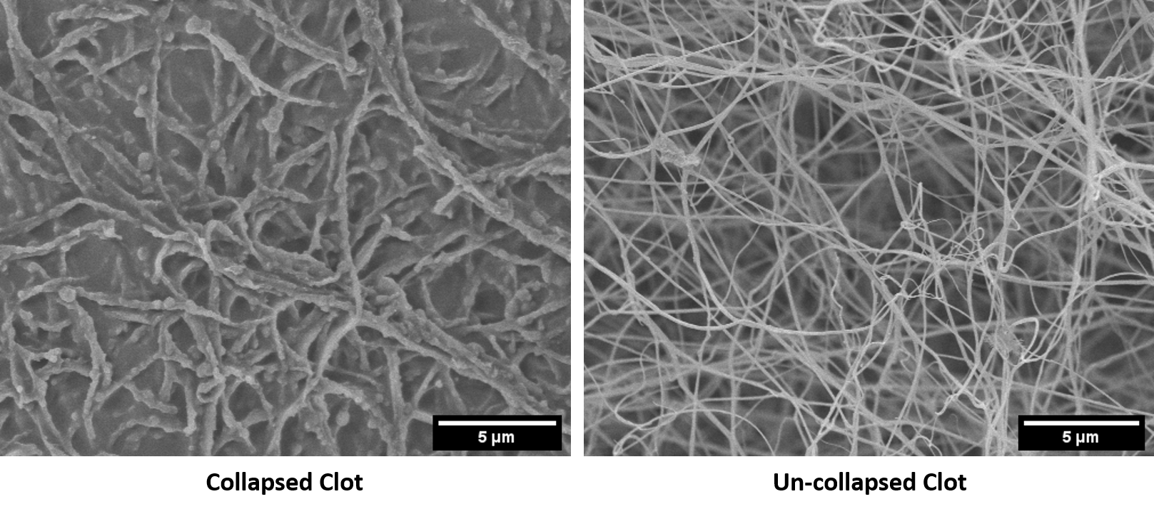 Clot Collapse in Scanning Electron Microscopy (SEM). ISTH Academy ...